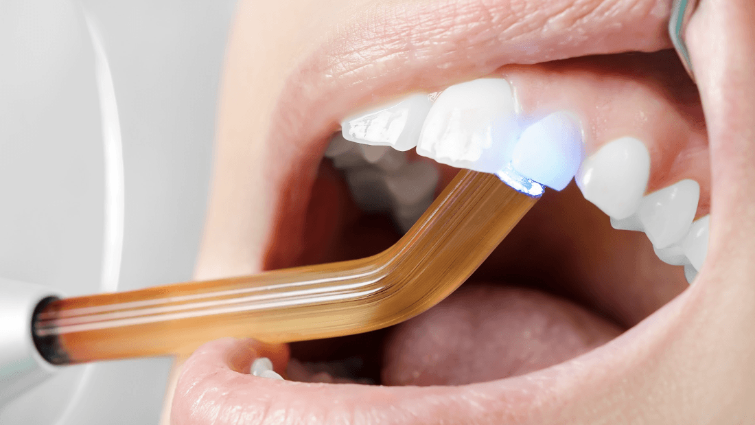 Stunning Smile Transformation | Full Smile Makeover Before & After